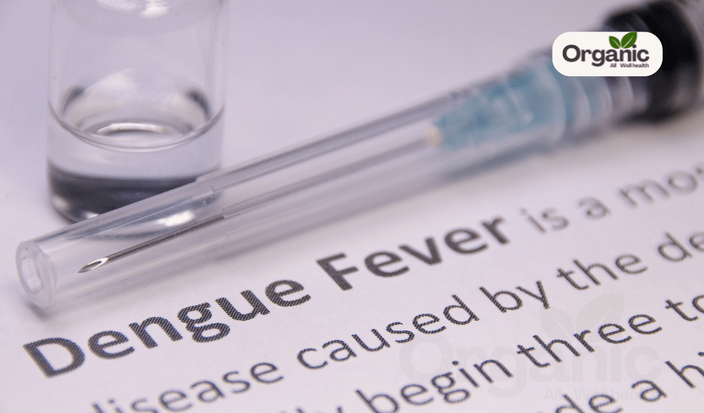How Is Dengue Fever Diagnosed
