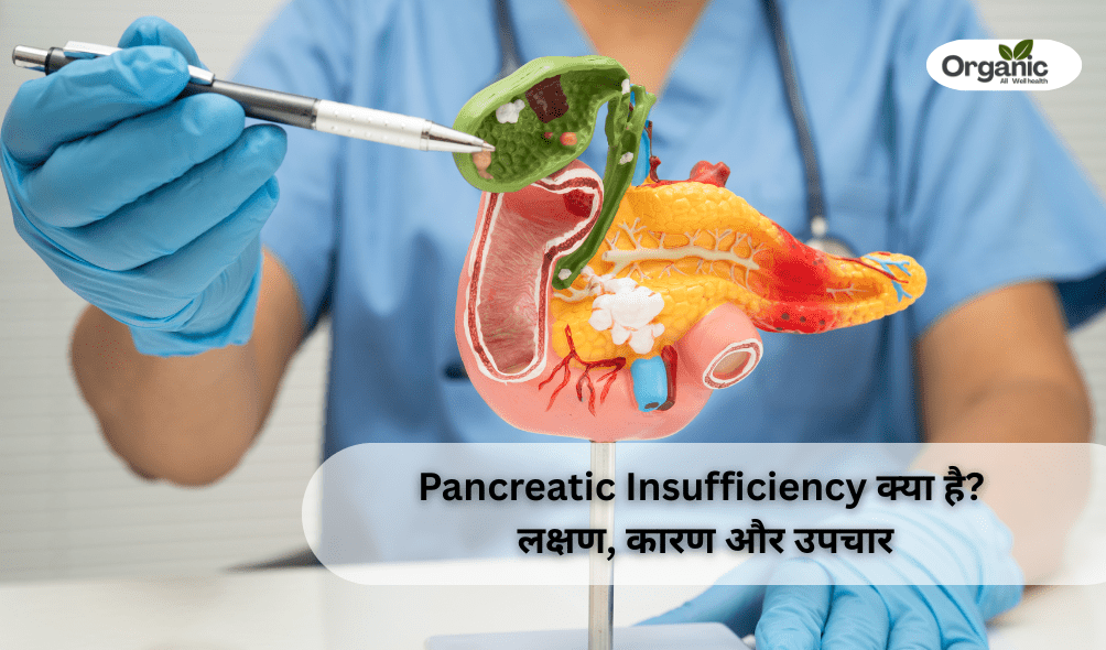 Pancreatic Insufficiency (EPI) क्या है? लक्षण, कारण और उपचार ...